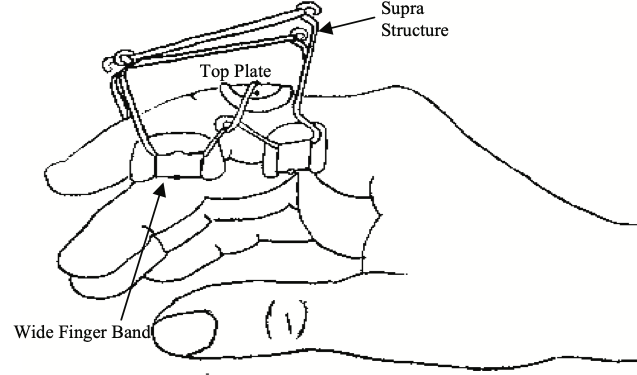 Capener finger splint Sporlastic
